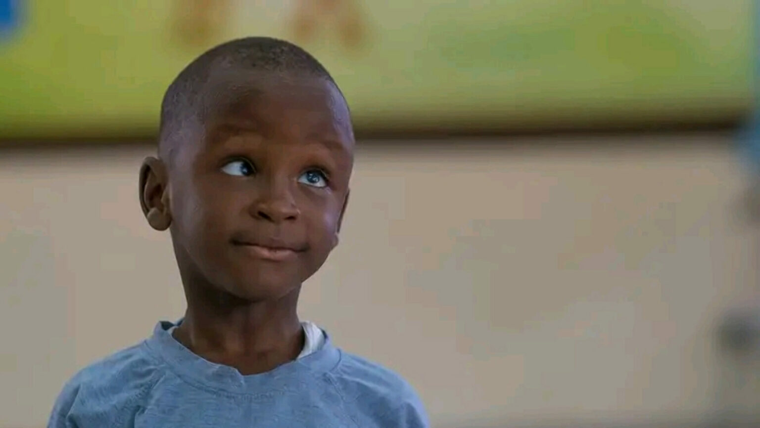 Squint in Children (Strabismus): Causes, Symptoms, Treatment